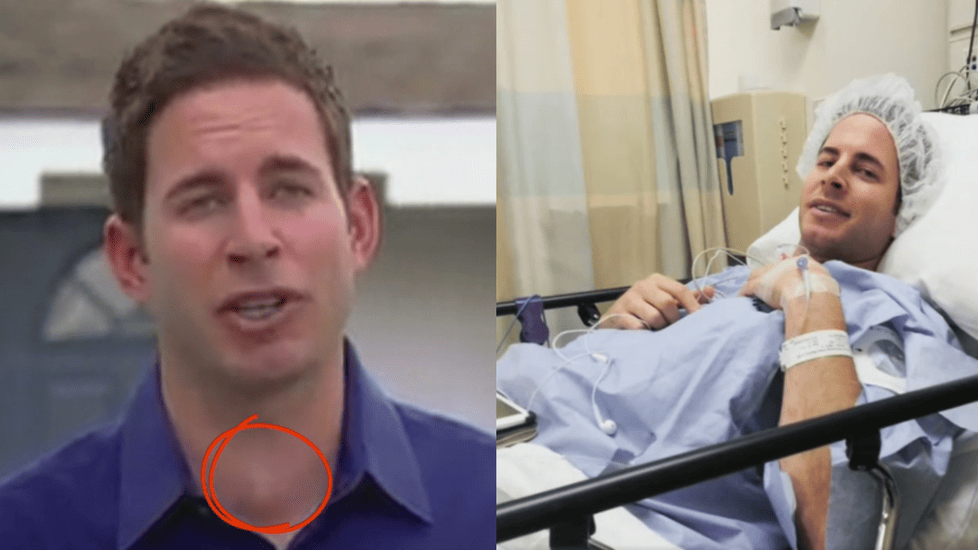 In a grim update, Tarek El Moussa’s doctor shared new details about his ...