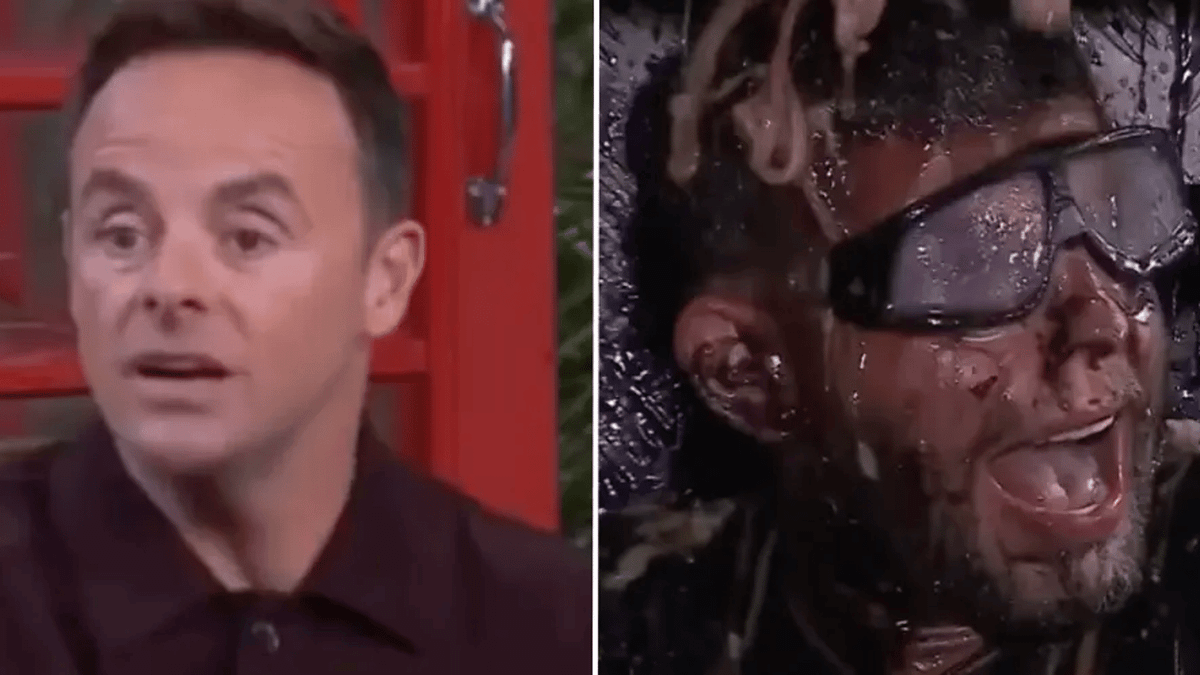 Ant McPartlin, host of I’m A Celebrity, revealed a serious physical ...